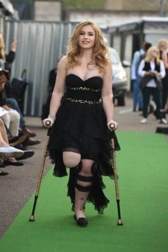 Top 10 Disabled Female Models From World You Must Know – Branded Girls