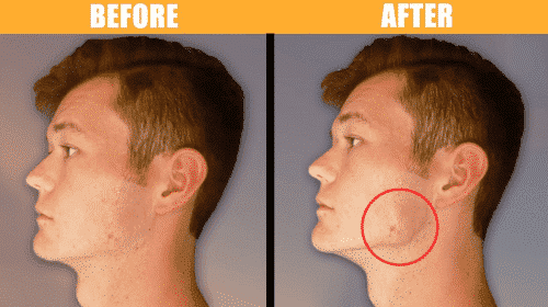 How To Get A Chiseled Jawline? 20+ Exercises & Tools To Use – Branded Girls