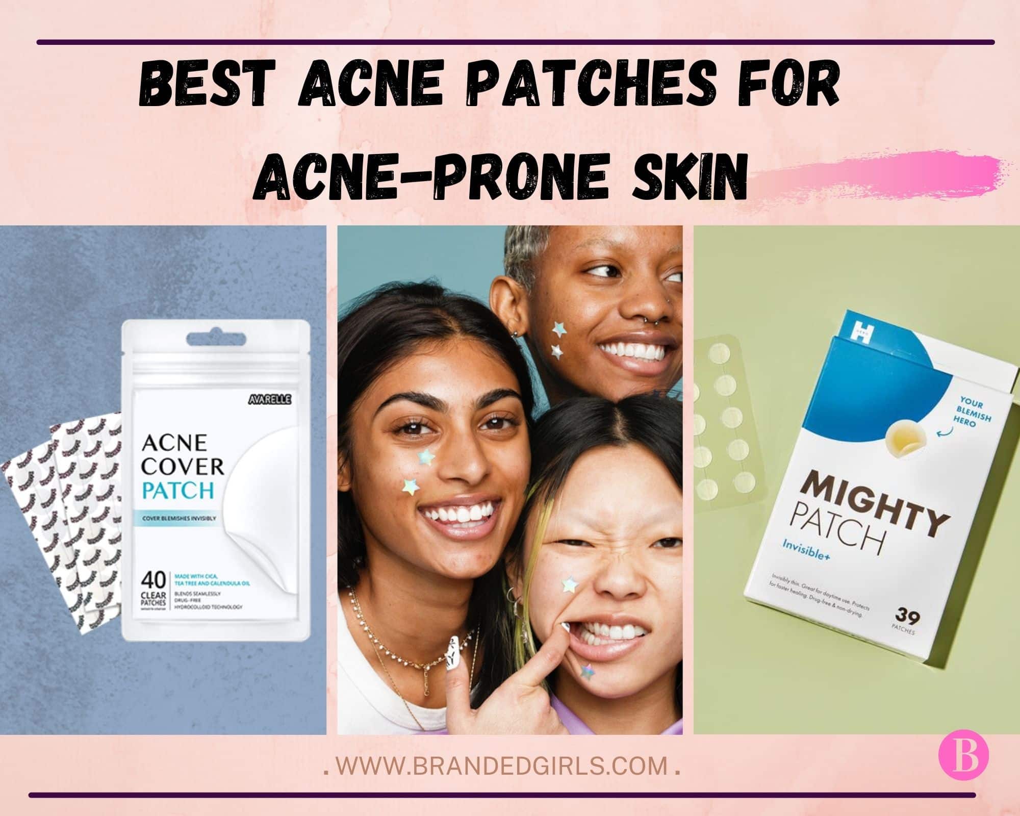 10 Best Acne Patch Brands For Acne Prone Skin With Reviews – Branded Girls
